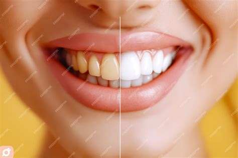Premium Photo A Womans Teeth Before And After Whitening