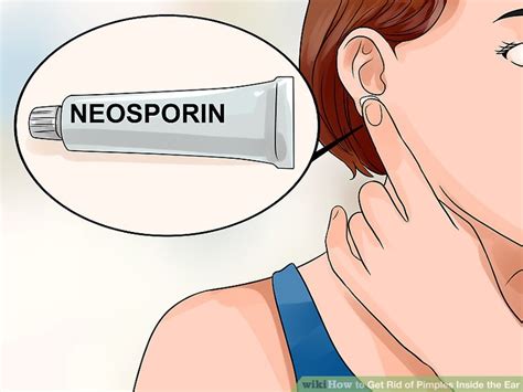 How To Get Rid Of Pimples Inside The Ear Strotyshop