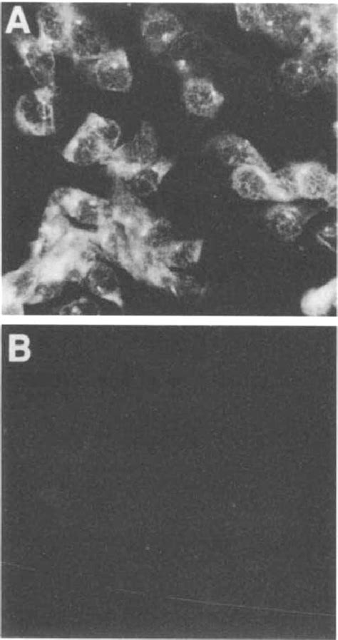 Indirect Immunofluorescent Labelling Of Mct Cells With Antibody
