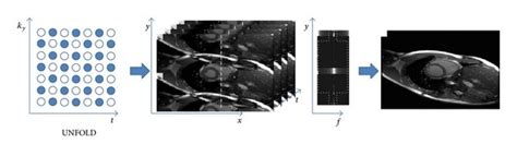 Illustration Of Three Dimensional K Space In Mri Generally The