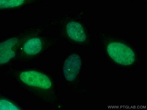 Rif1 Antibody Cl488 30119 Proteintech
