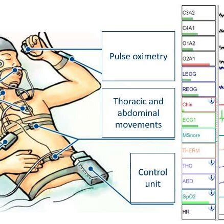 Graphical Representation Of Traces Of The Polysomnography Technology 5