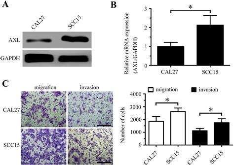 Cancer Associated Fibroblasts Contribute To Oral Cancer Cells