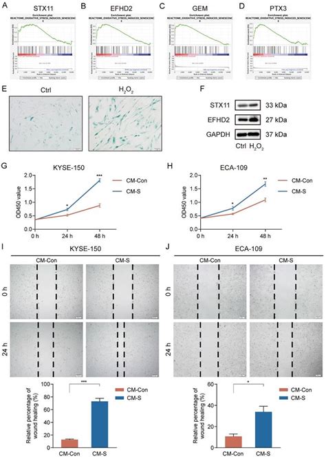 Integrative Analysis And Validation Of A Cancer Associated Fibroblasts