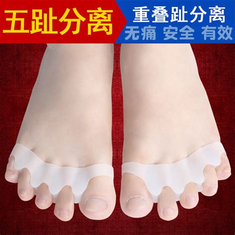 日本大拇指外翻矫正器大脚骨脚趾重叠分趾器分离器小脚趾内翻矫正 虎窝淘