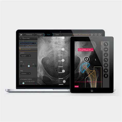 Orthopedic Templating Software