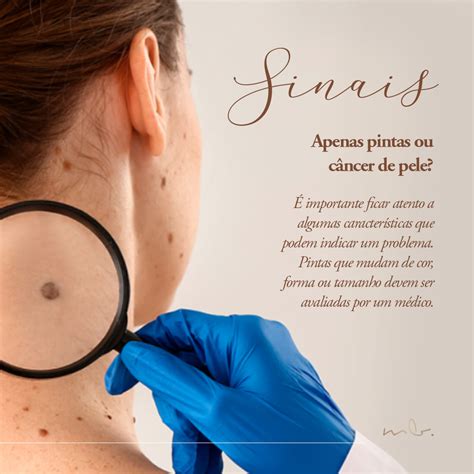 Dra Melissa Bristot Dermatologista Apenas Um Sinal Pinta Ou