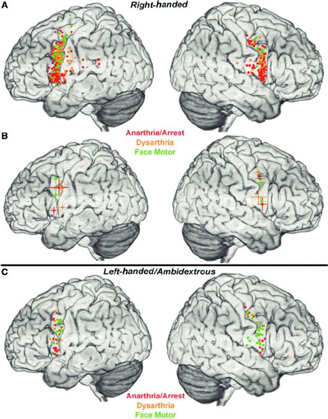 Cortical Distribution Of Articulation Related Sites A And B Raw