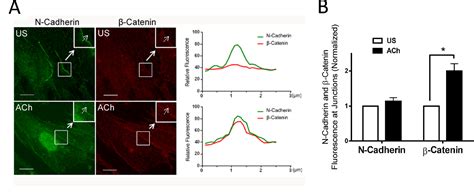Figure 2 From Recruitment Of β Catenin To N Cadherin Is Necessary For Smooth Muscle Contraction