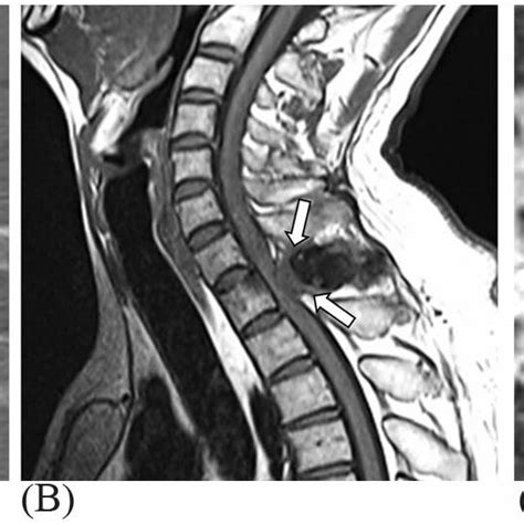Preoperative Computed Tomography Ct Image And Magnetic Resonance