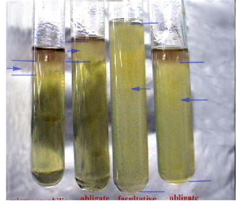 Fluid Thioglycolate Broth Flashcards Quizlet
