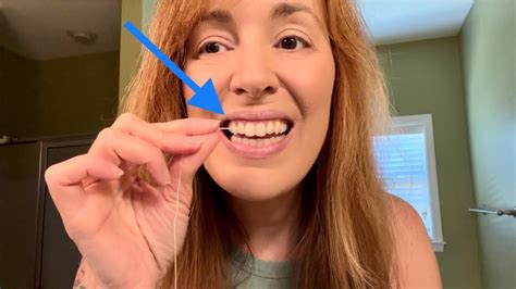 How To Use A Floss Threader With Permanent Retainer At Agnes Hendricks Blog