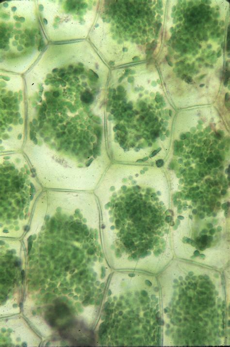 Elodea Leaf Cell Under Microscope Labeled Micropedia
