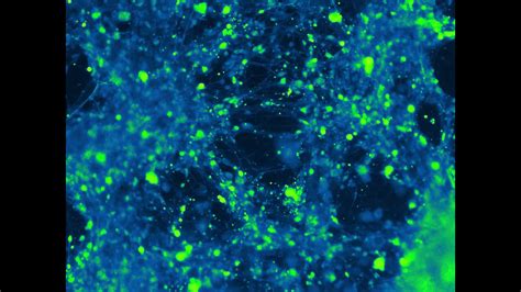 Simon Andrews On Linkedin Ipsc Derived Neurons And Astrocytes