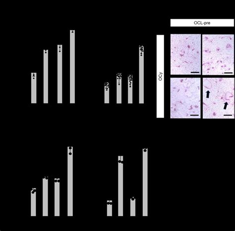 OCL Formation By Co Culture With OCy Like Cells From MVNP And WT Mice