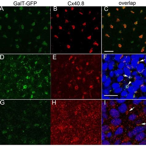 Hela Cells Were Singly Transfected With Egfp Fusions Of Each Construct