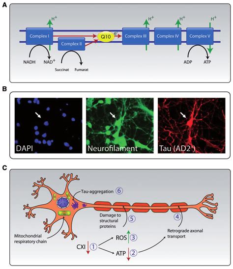 Pathophysiological Concept Of Mitochondrial Dysfunction In Psp A The