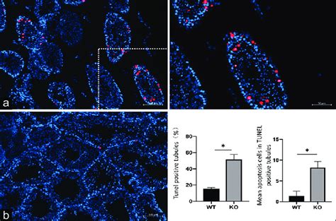 Germ Cell Apoptosis Increased In Knockout Mice A Cell Apoptosis Was