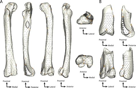 Figures And Data In Femora From An Exceptionally Large Population Of