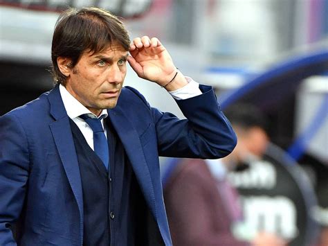 Opinon On Antonio Contes Hairtransplant Result Open Hair Loss