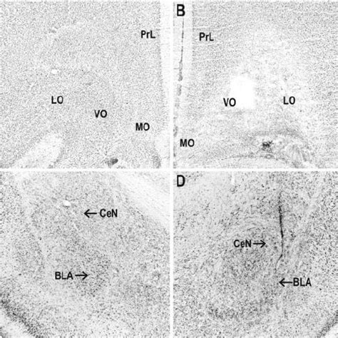 A D Photomicrographs Depicting A Typical Ofc Lesion B And Bla Download Scientific