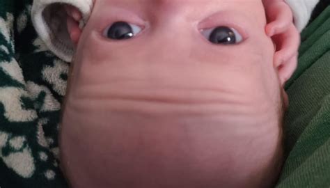 My Daughters Forehead Wrinkles Look Like A Weird Mouth Rpics