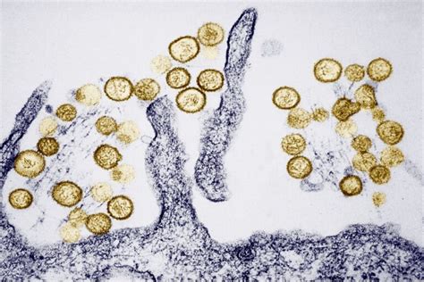 Australian Virus Lab Loses Track Of Hundreds Of Deadly Germs In ‘major Biosecurity Breach