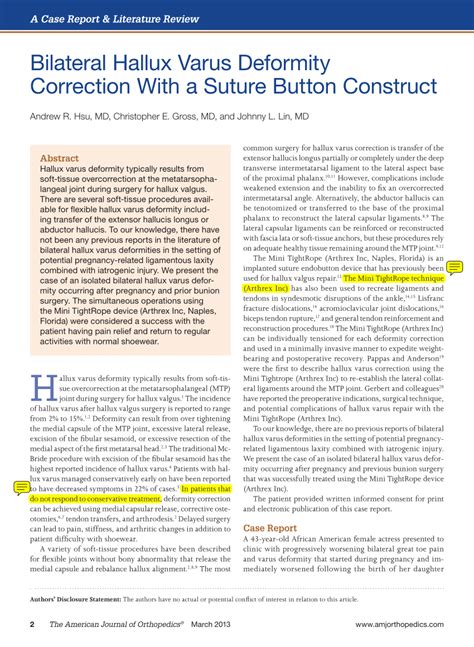 Pdf Bilateral Hallux Varus Deformity Correction With A Suture Button Construct
