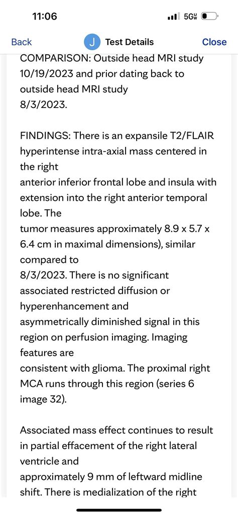 3 Days Til Craniotomy For Partial Tumor Resection What To Expect R