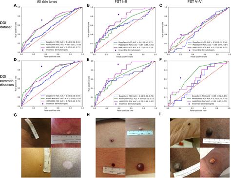 Training Physicians And Algorithms In Dermatology Diversity Trendradars