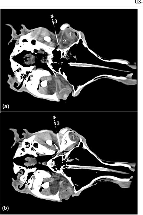 [pdf] development of an ultrasound guided technique for retrobulbar