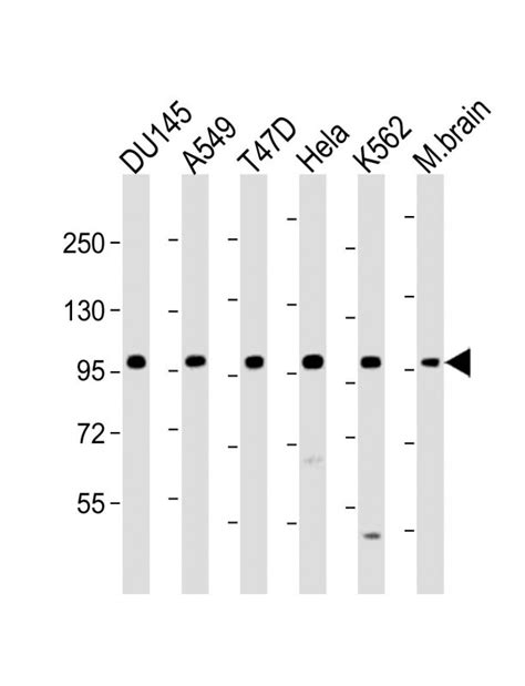 Fgfr2 Antibody N Term Affinity Purified Rabbit Polyclonal Antibody
