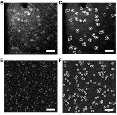 Commoditizing Population Calcium Imaging Analysis Labrigger