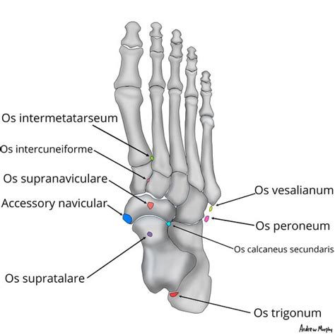 Accessory Bones Of The Foot And Ankle Wikism Sports Medicine Wiki
