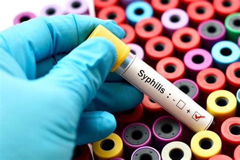 Ive Got Syphilis Is It Curable
