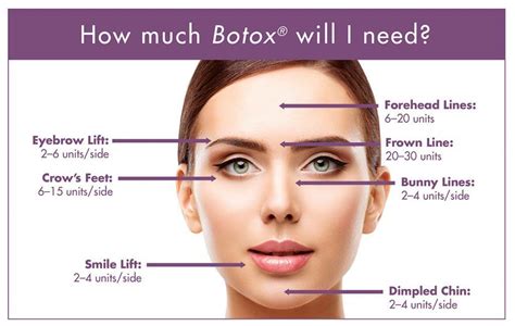 How Long Did It Take Your Botox To Work At Bobbye Pederson Blog