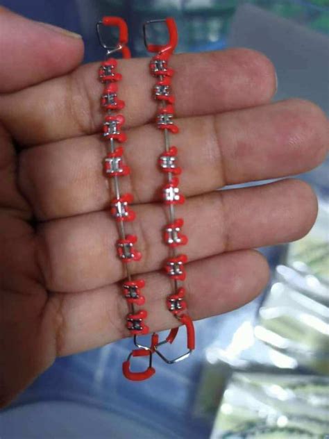 Hello Kitty Braces Designs