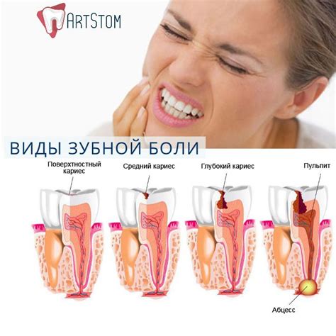 Dental Videos Dental Posters Dental Technician Muscle Anatomy