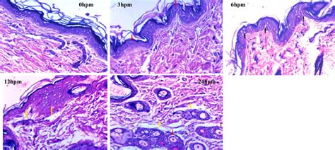 Photomicrographs Of Hande Stained Sections Of Skin Tissue Of Adult Male