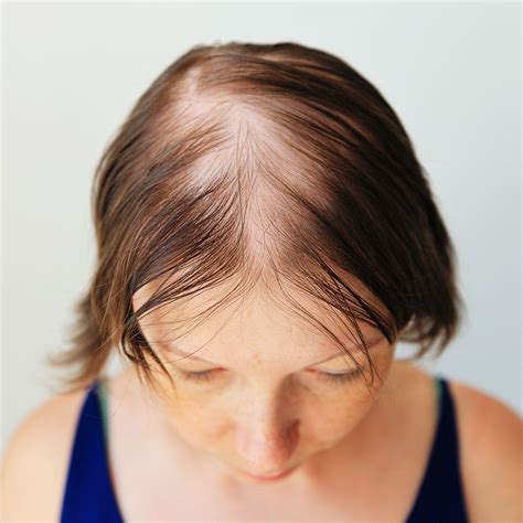 These Are The Best Ways To Bring Volume Back To Thinning Flat Hair