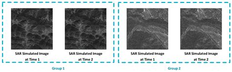 Deep Learning For Integrated Speckle Reduction And Super Resolution In