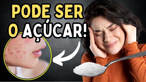 VÍdeo Sinais De Que VocÊ EstÁ Consumindo Muito AÇÚcar Dr Dayan