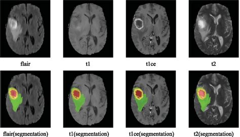 Input Images With Four Mri Modalities And The Corresponding Download Scientific Diagram