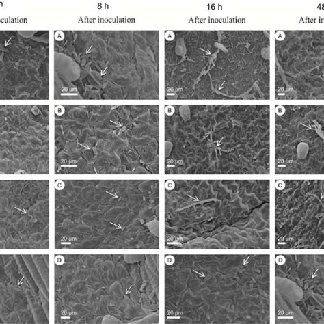 Scanning Electron Microscopy Of Bean Leaves Inoculated With C Download Scientific Diagram