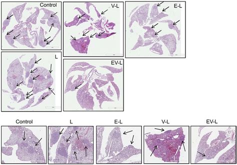 Inhibition Of Lung Metastasis In 786 O Xenografted Mice The Dual