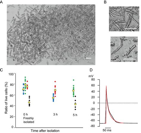 An Antegrade Perfusion Method For Cardiomyocyte Isolation From Mice