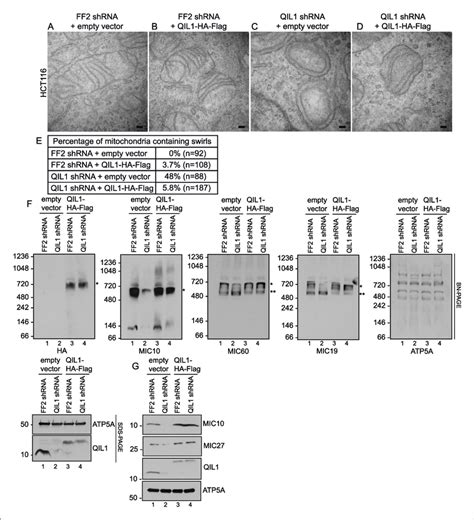 Cristae Morphology Defects Micos Disassembly And Mic10 And Mic26 Download Scientific Diagram