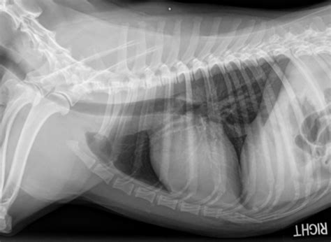 Thorax Radiology Flashcards Quizlet