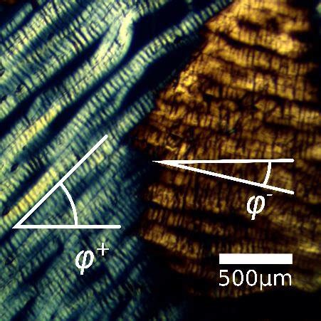 Representative Polarized Light Micrograph Taken From Middle Depth Of