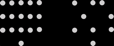Dropout Neural Network Model I A Standard Neural Network With No